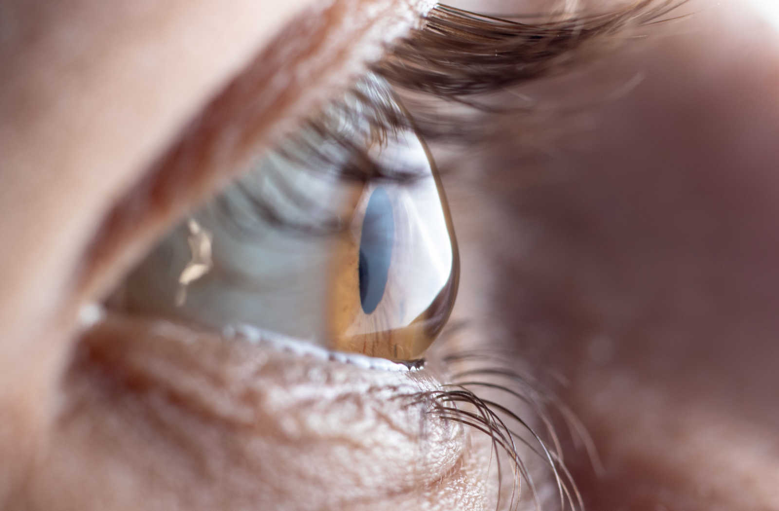 Why Are My Eye Axis So Different North York Ontario