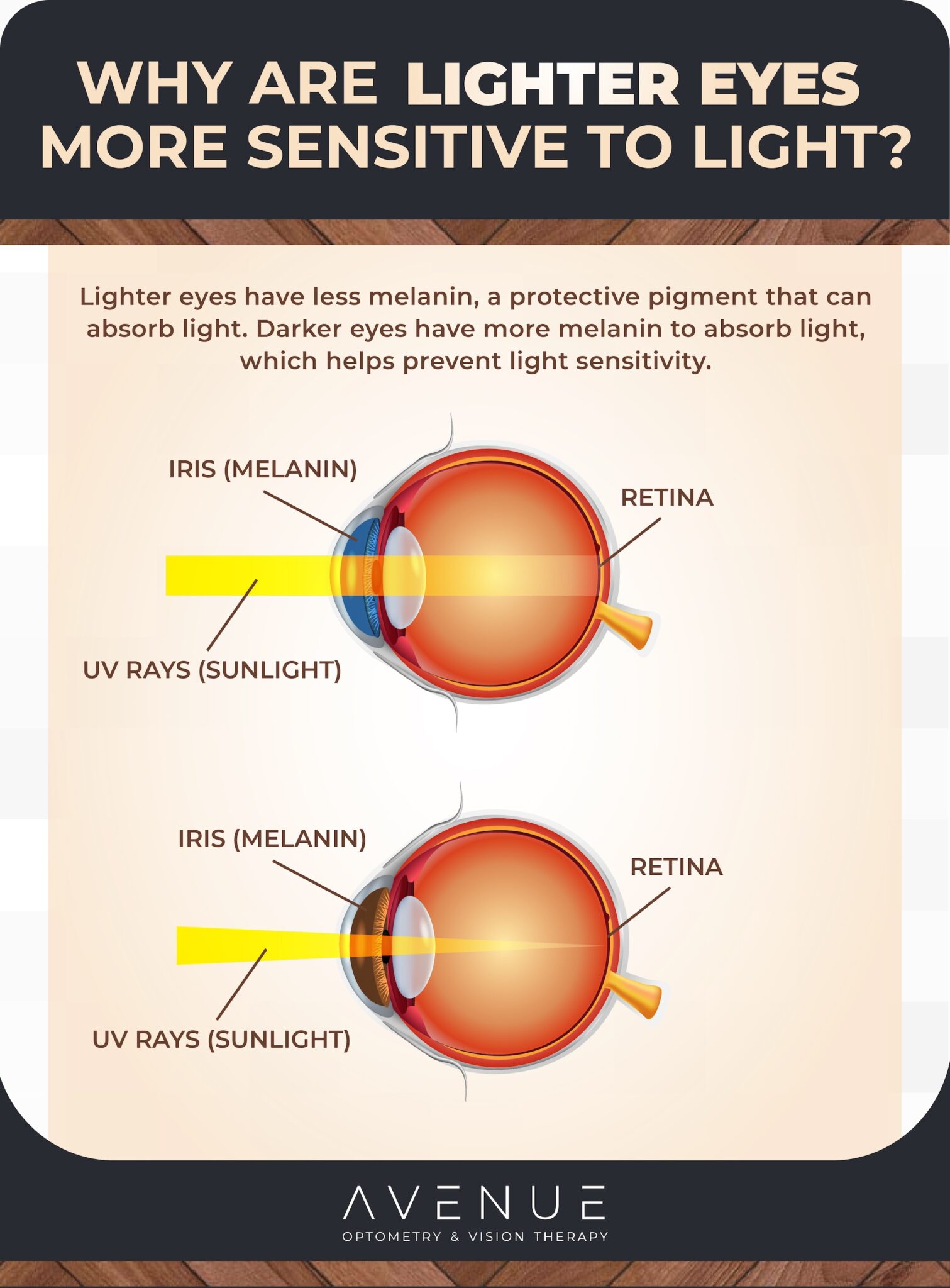 Are Lighter Eyes More Sensitive to the Sun?